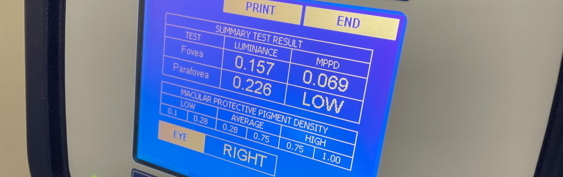 macula pigment density measurement - Parley Optometrists
