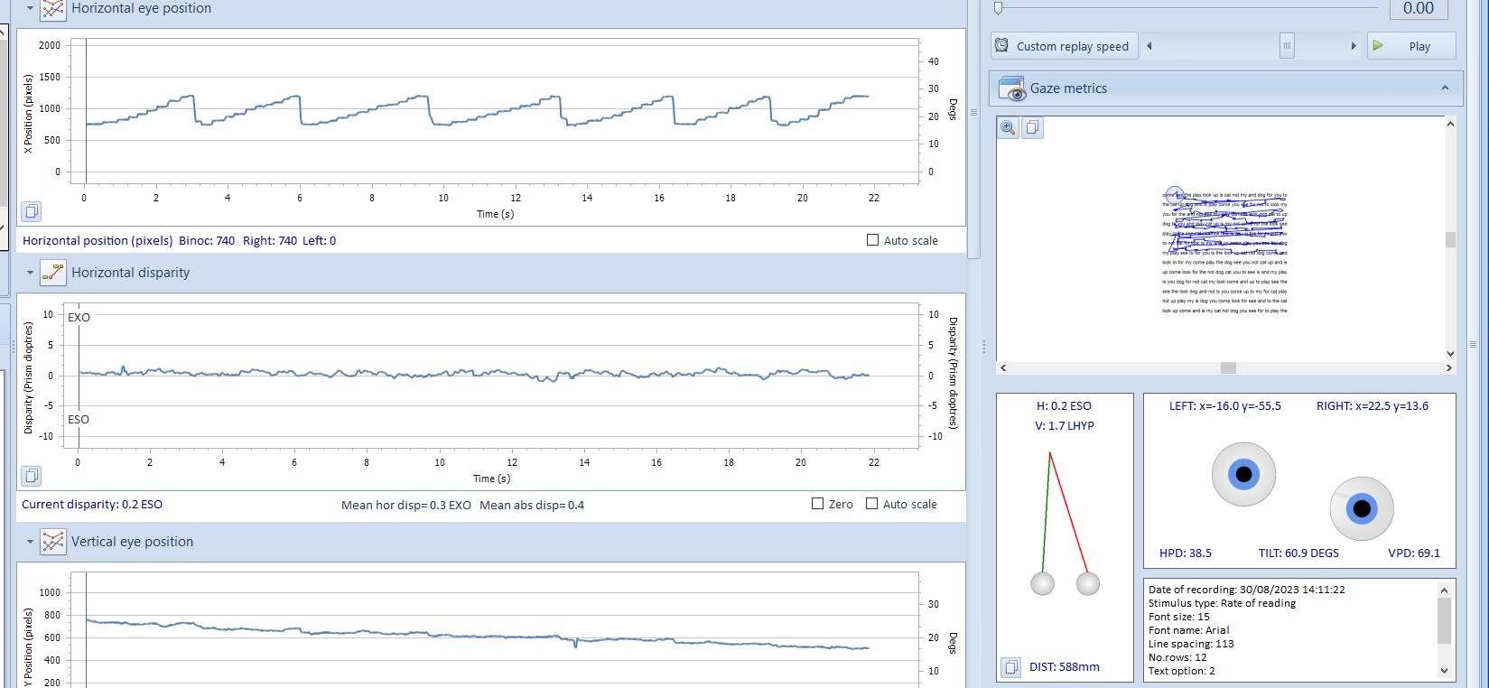 Clinical Eye Tracking Assessments - Parley Optometrists